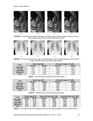 Contourlet Transform Based Method For Medical Image Denoising | PDF