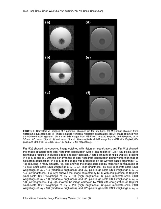 Correction of Inhomogeneous MR Images Using Multiscale Retinex | PDF