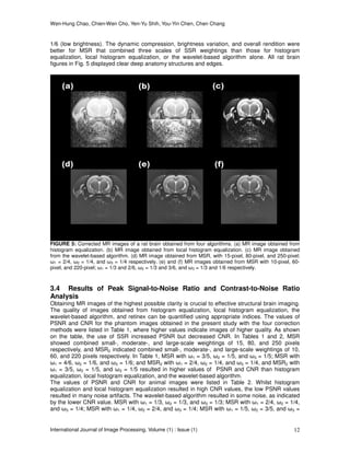 Correction of Inhomogeneous MR Images Using Multiscale Retinex | PDF