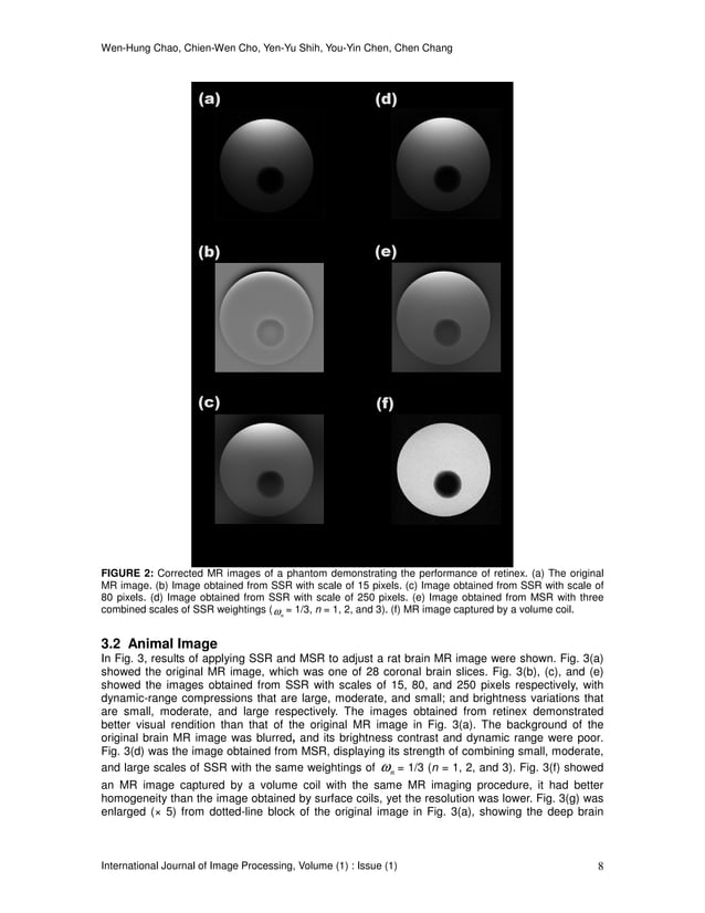 Correction of Inhomogeneous MR Images Using Multiscale Retinex | PDF