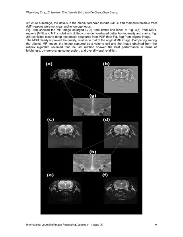 Correction of Inhomogeneous MR Images Using Multiscale Retinex | PDF