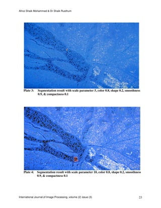 Object-Oriented Image Processing Of An High Resolution Satellite ...