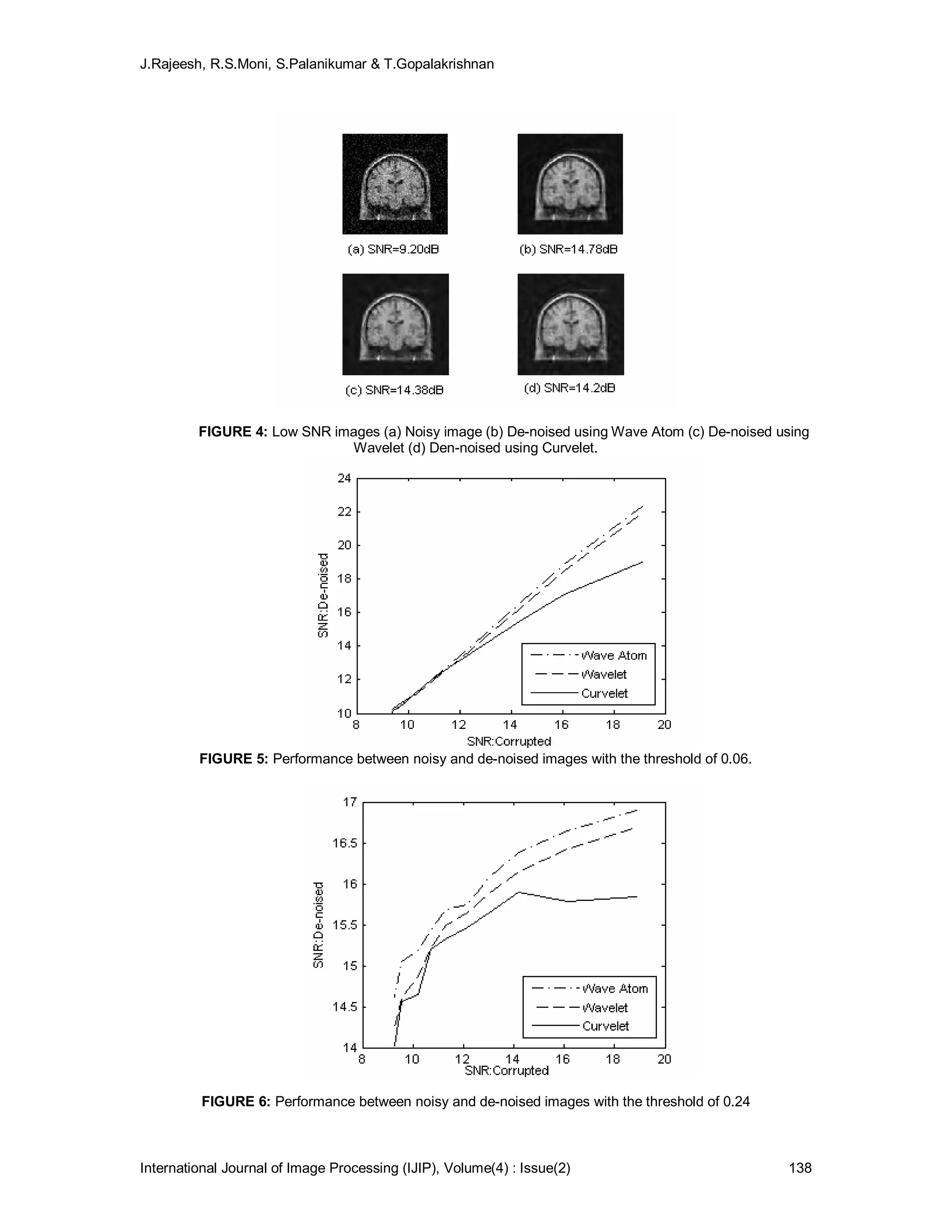 Noise Reduction in Magnetic Resonance Images using Wave Atom Shrinkage | PDF