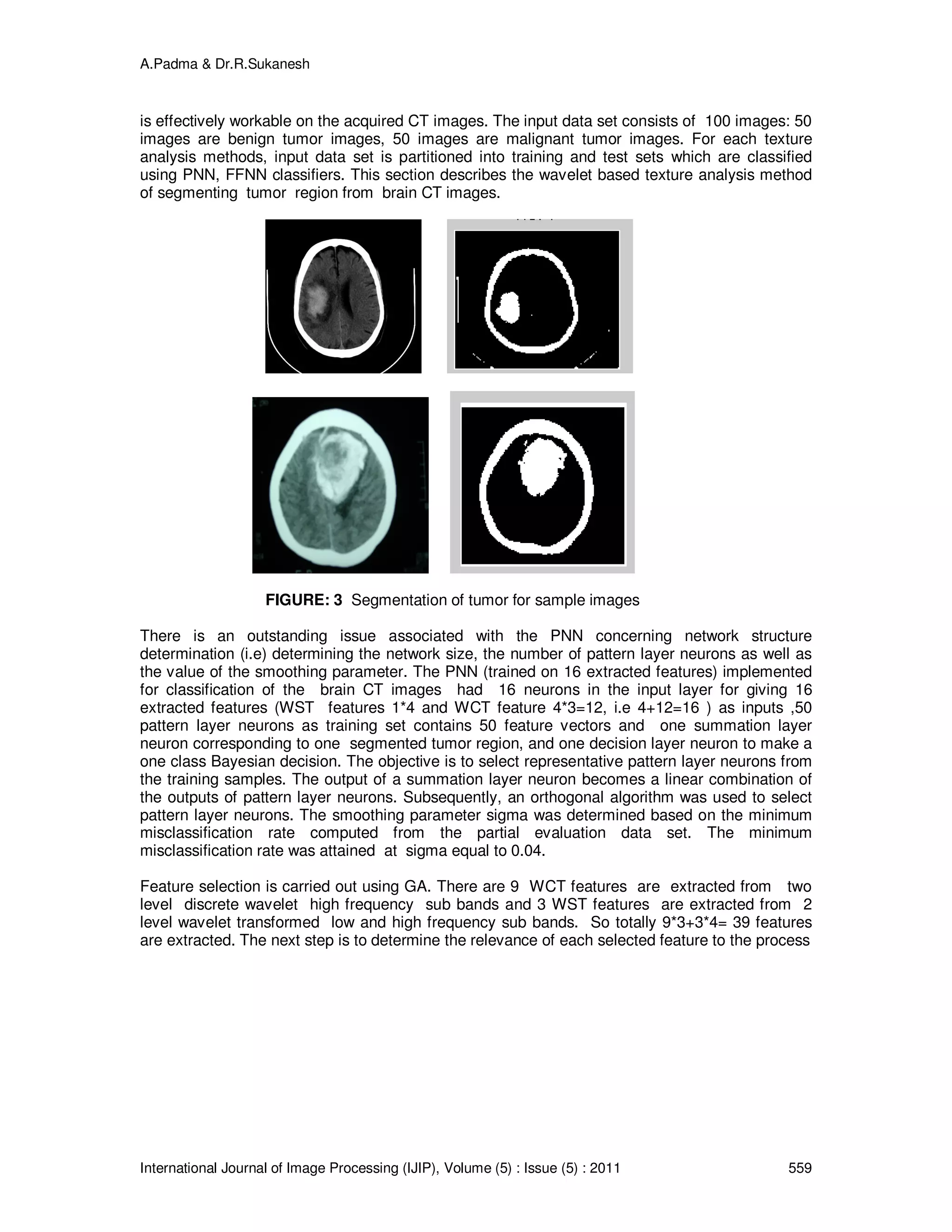 A Wavelet Based Automatic Segmentation Of Brain Tumor In Ct Images