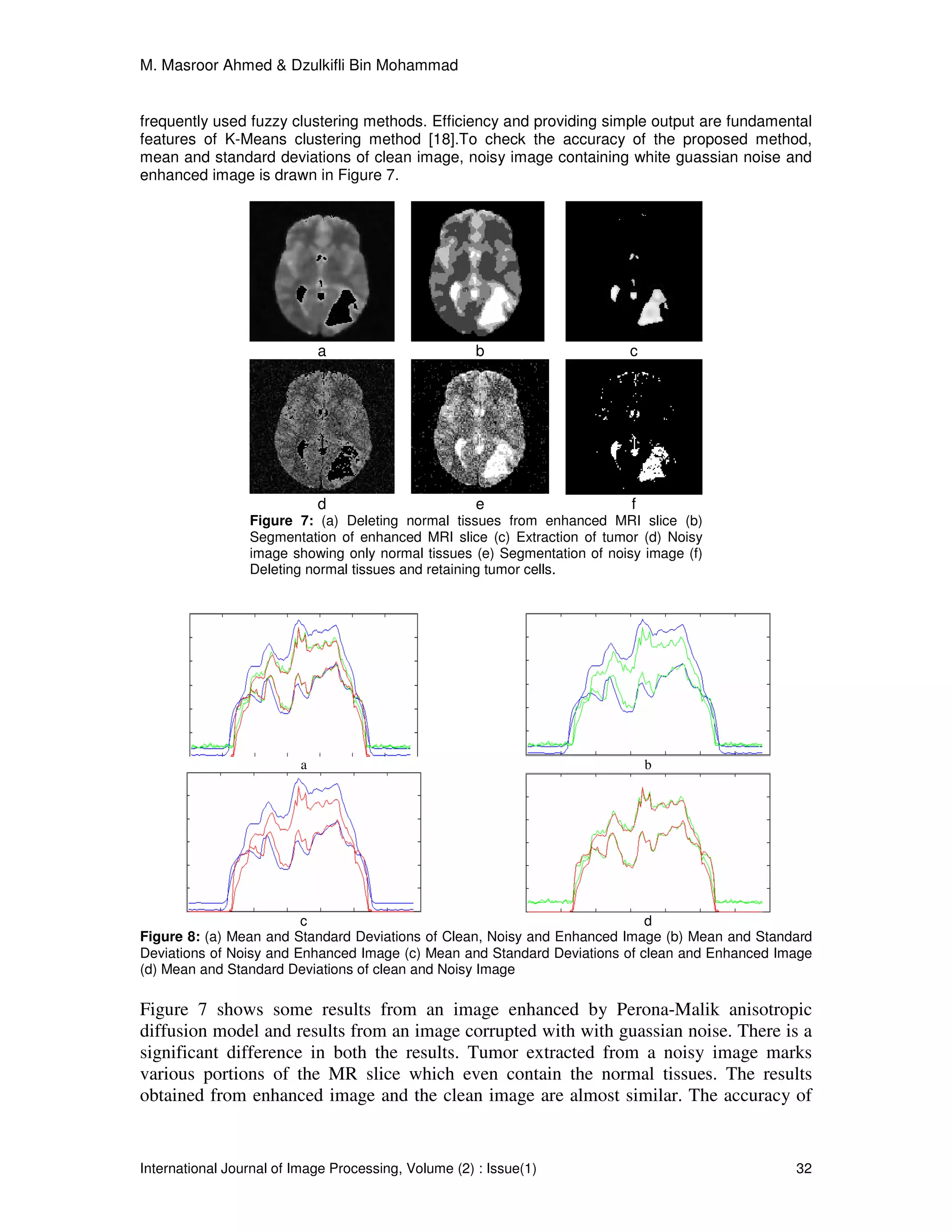 Segmentation of Brain MR Images for Tumor Extraction by Combining Kmeans Clustering and Perona ...