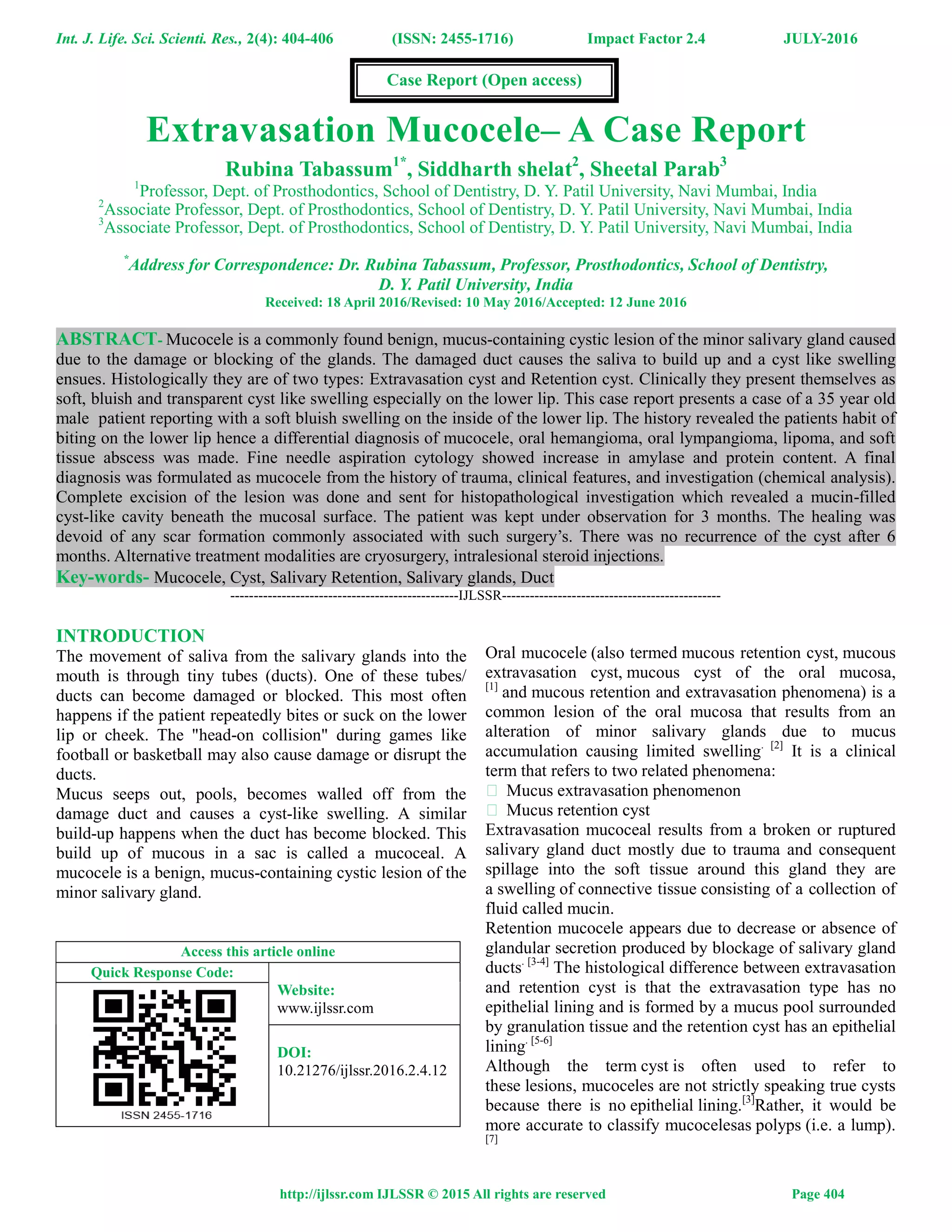 Extravasation Mucocele– A Case Report | PDF