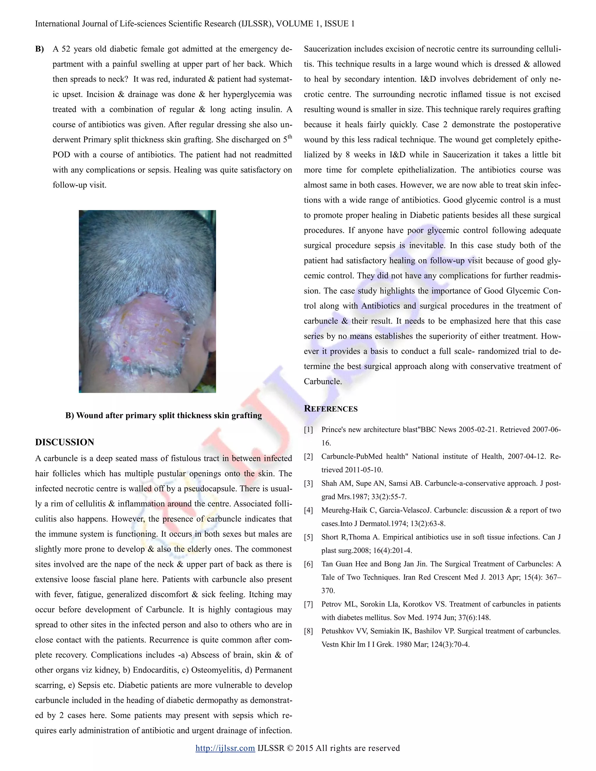 CARBUNCLE, MODALITIES OF TREATMENT – CASE REPORT | PDF