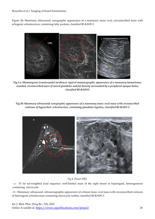 Imaging of breast hamartomas | PDF