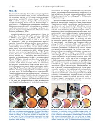 Smartphone guided wide-field imaging for retinopathy of prematurity in ...