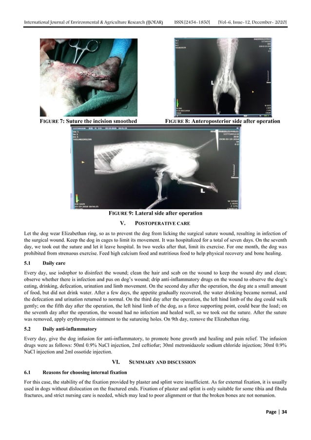 One Case of Internal Fixation Treatment for Tibia and Fibula Fracture ...