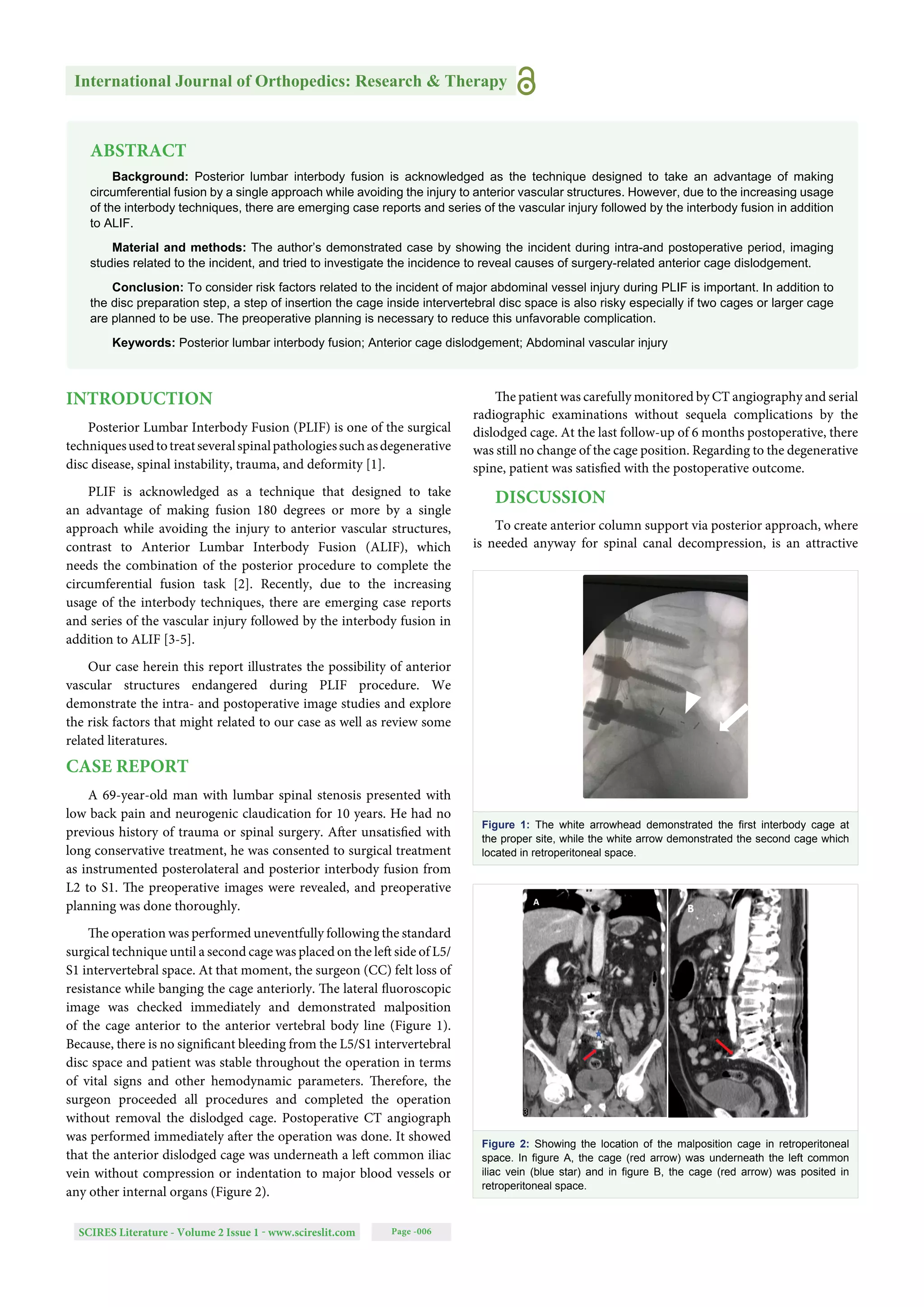 International Journal of Orthopedics: Research & Therapy | PDF