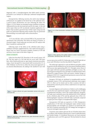 International Journal of Rhinology & Otolaryngology | PDF