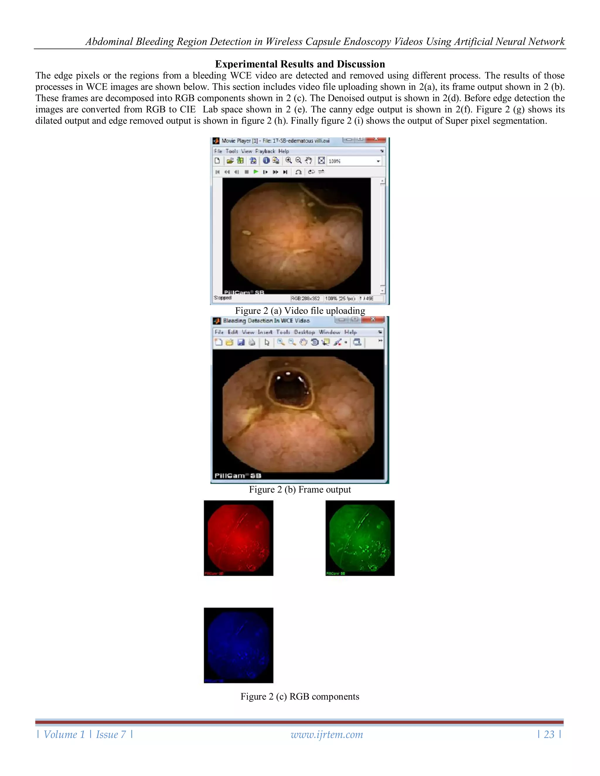 Abdominal Bleeding Region Detection in Wireless Capsule Endoscopy Videos Using Artificial Neural ...