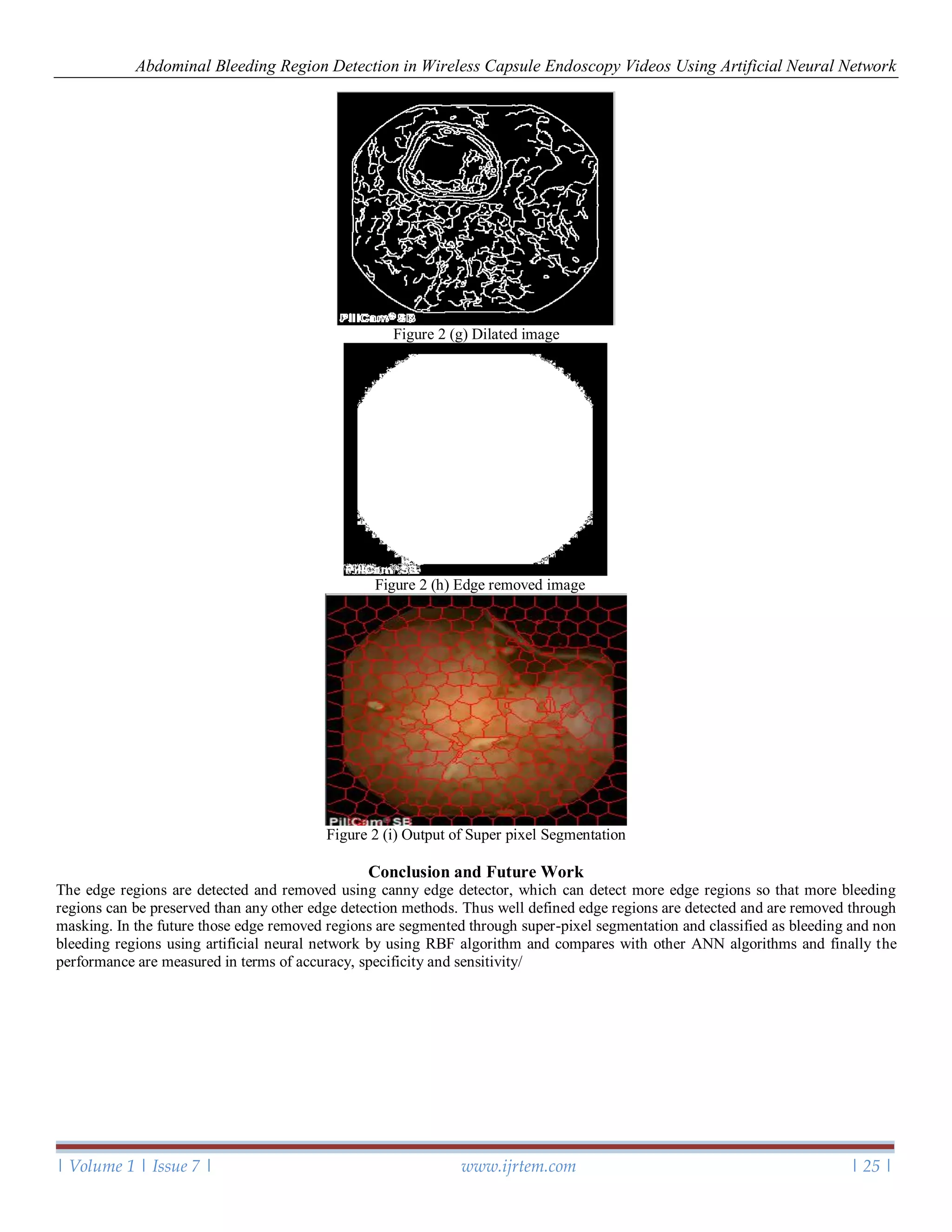 Abdominal Bleeding Region Detection In Wireless Capsule Endoscopy Videos Using Artificial Neural 
