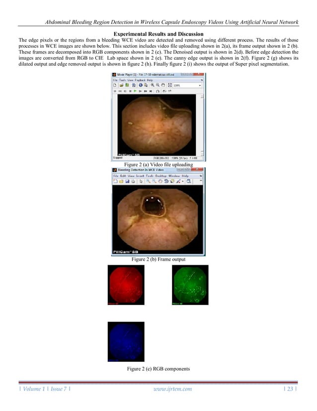 Abdominal Bleeding Region Detection In Wireless Capsule Endoscopy Videos Using Artificial Neural