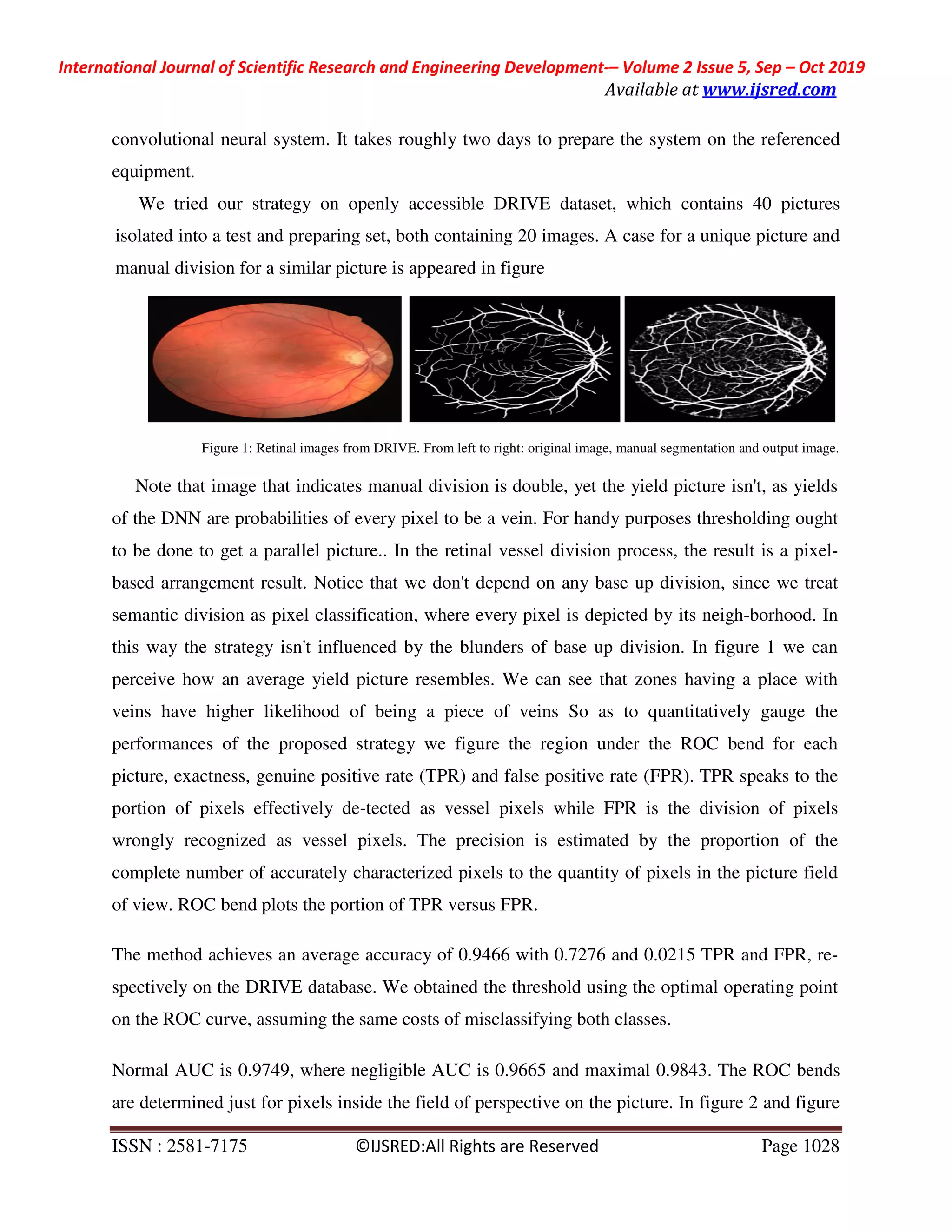 Retinal Blood Vessels Exudates Classification For Detection Of ...