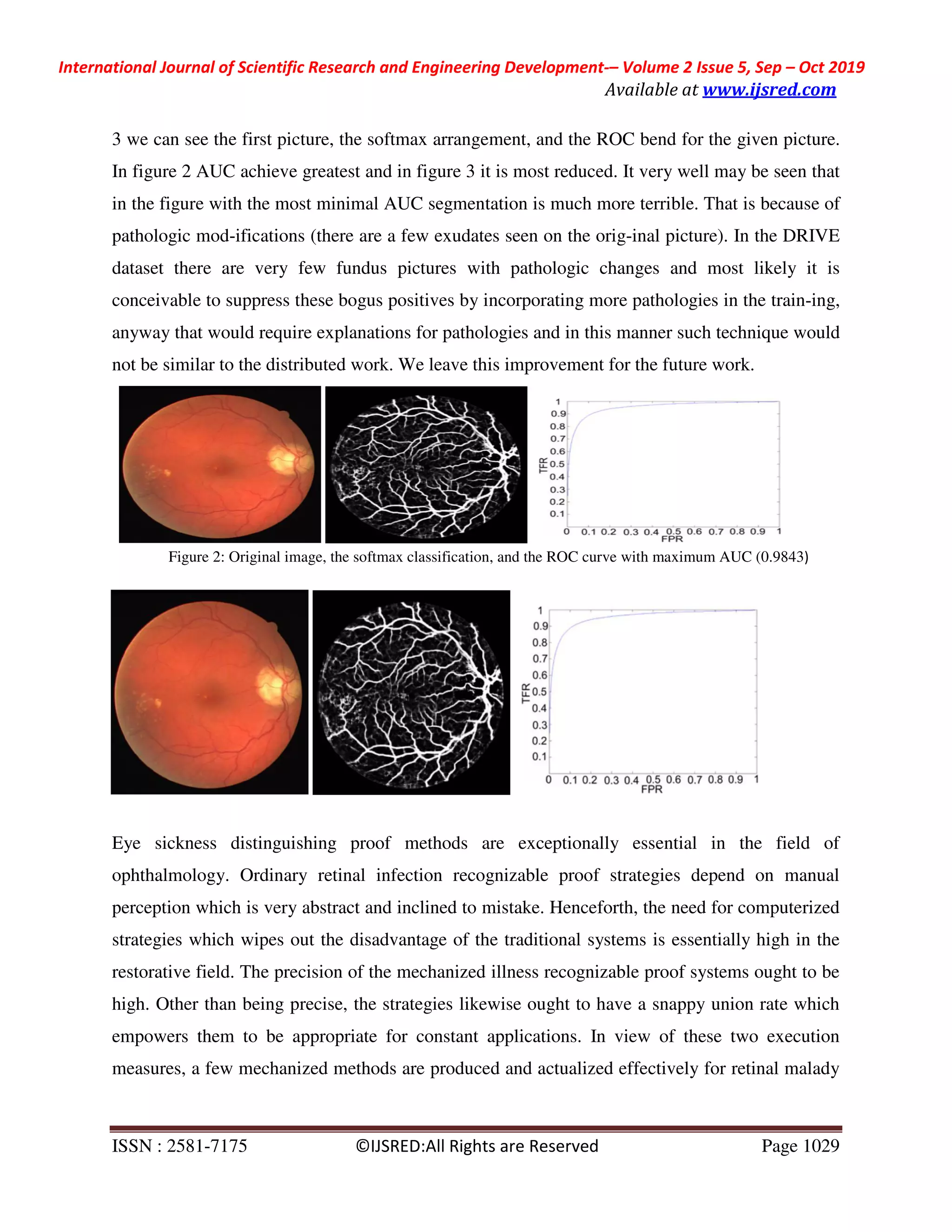 Retinal Blood Vessels Exudates Classification For Detection Of ...