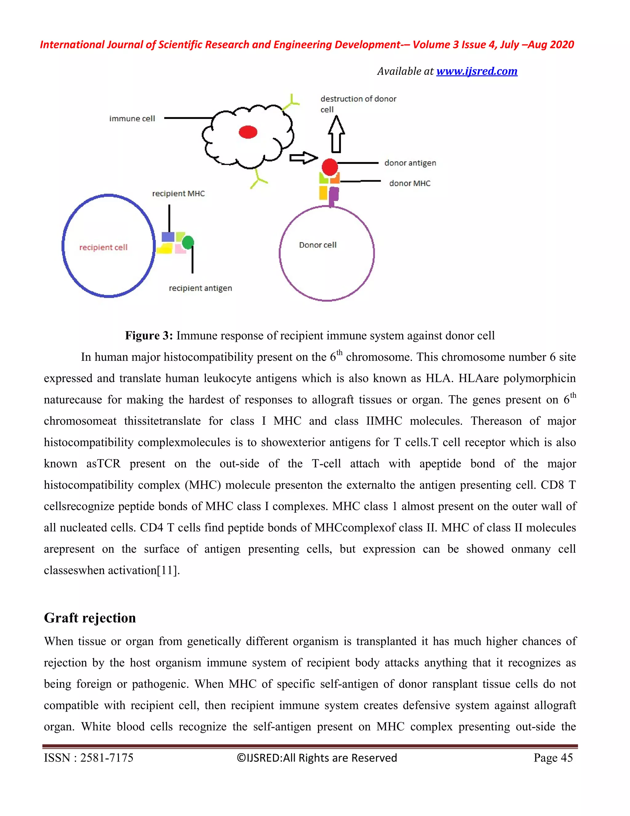 Organ Transplantation Methods and Major Reasons of Organ Rejection | PDF