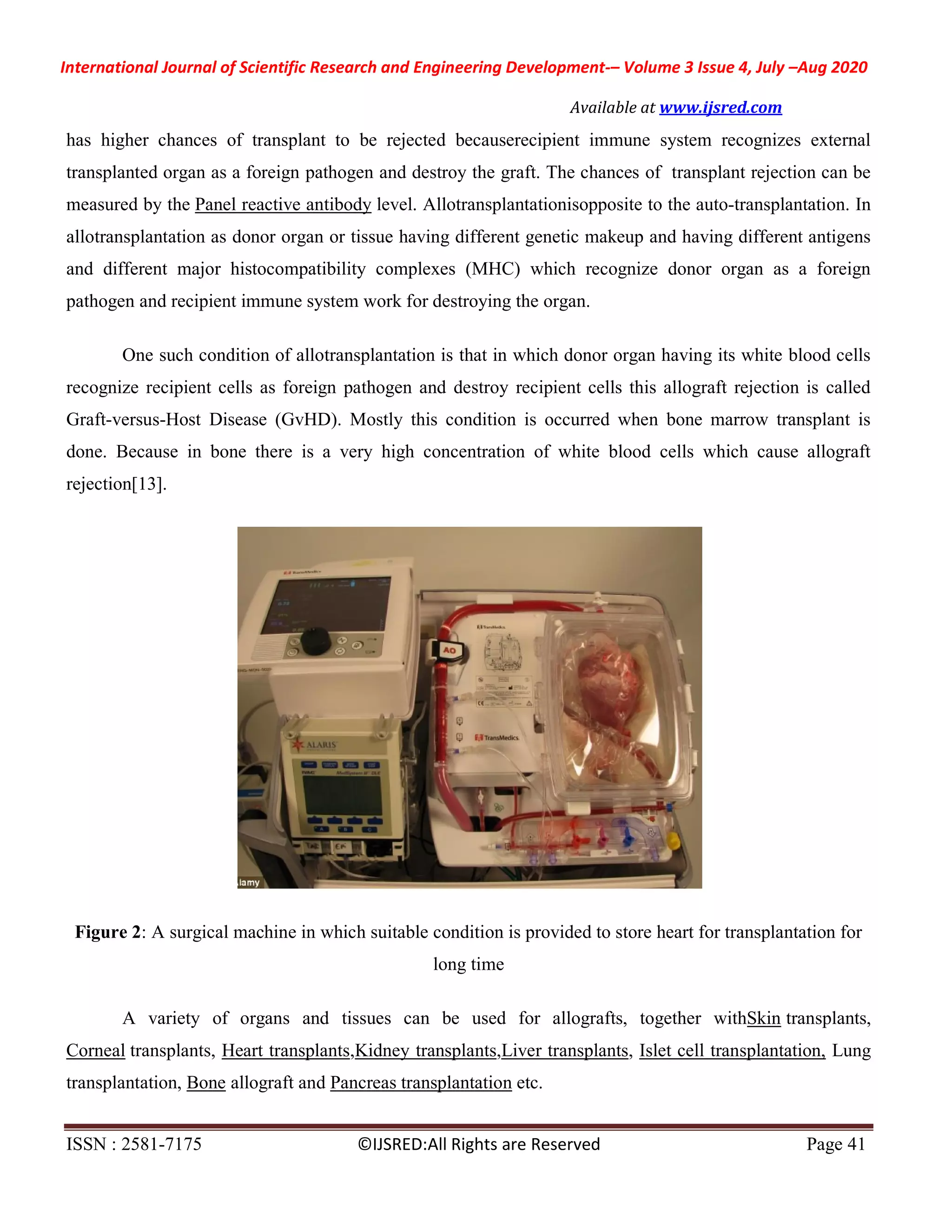 Organ Transplantation Methods and Major Reasons of Organ Rejection | PDF