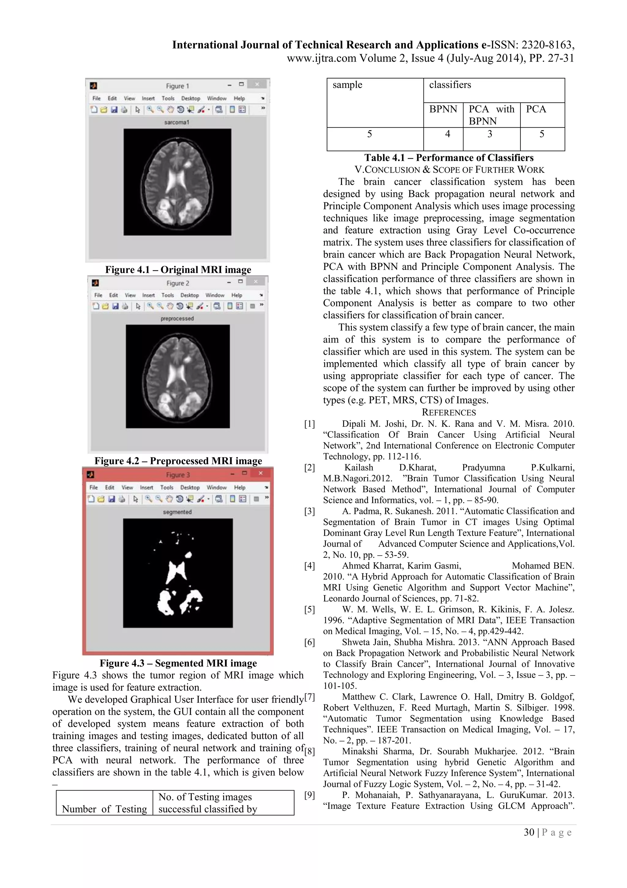 BRAIN CANCER CLASSIFICATION USING BACK PROPAGATION NEURAL NETWORK AND ...