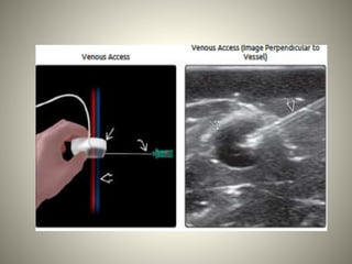 anatomical review of internal jugular vein cannulation.pptx