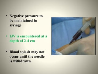 anatomical review of internal jugular vein cannulation.pptx
