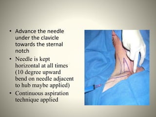 anatomical review of internal jugular vein cannulation.pptx