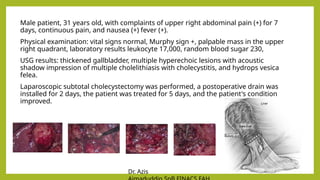 laparoscopy subtotal cholesistectomy for acut cholecystitis | PPTX