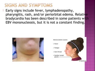 Infectious mononucleosis | PPT