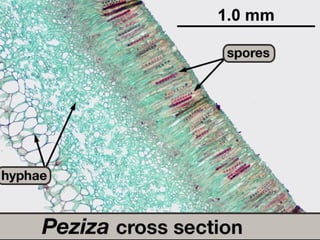 Peziza Under Microscope Labeled