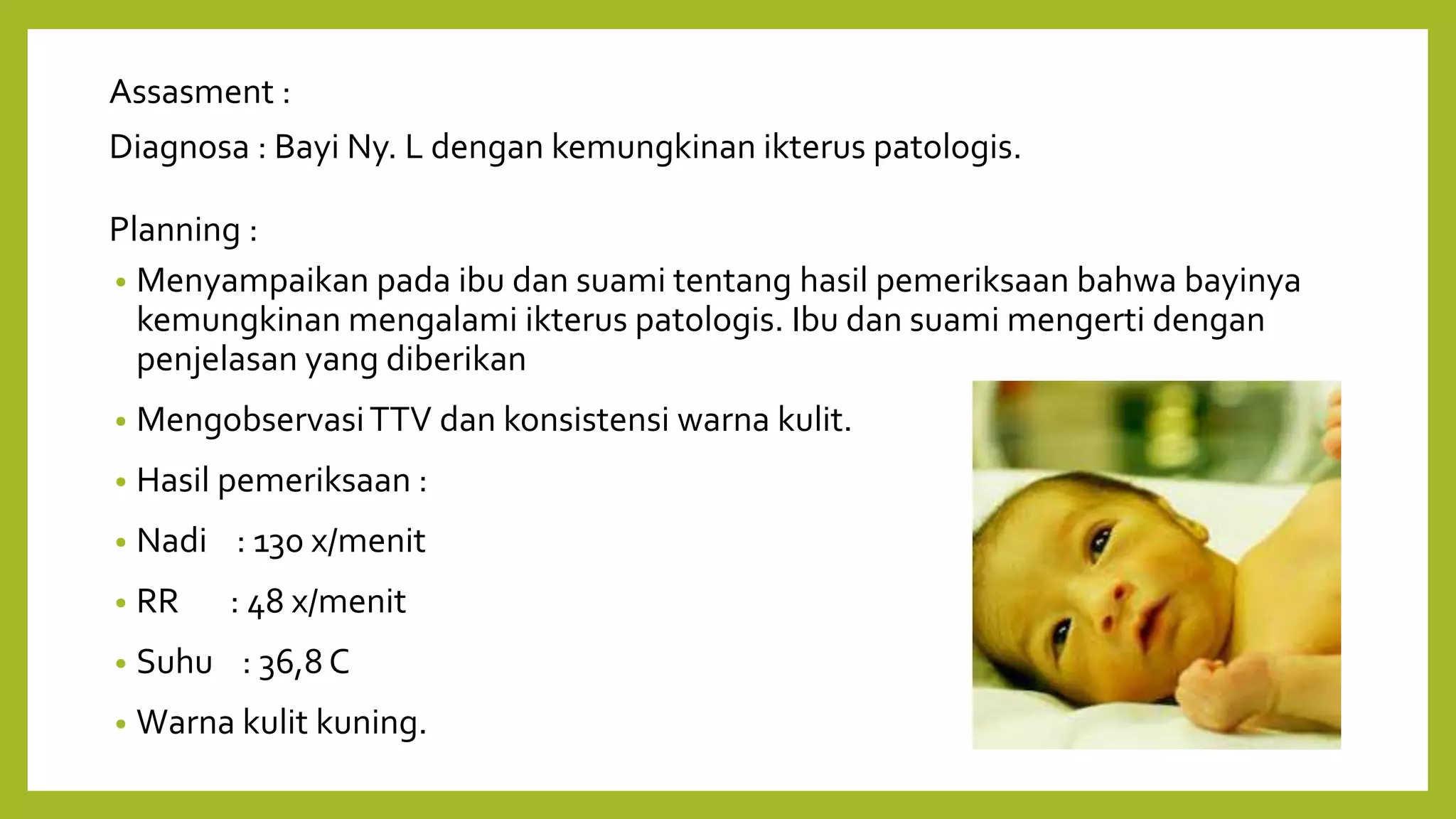 Ikterus Neonatus | PPTX