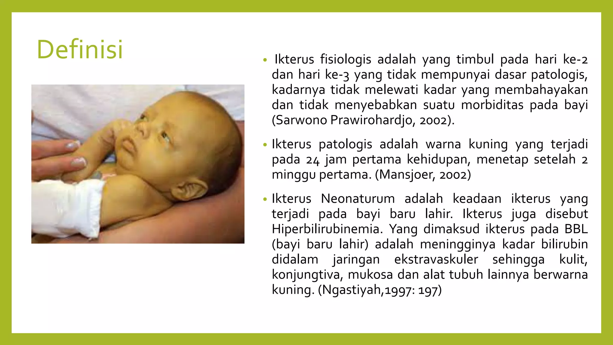Ikterus Neonatus | PPTX