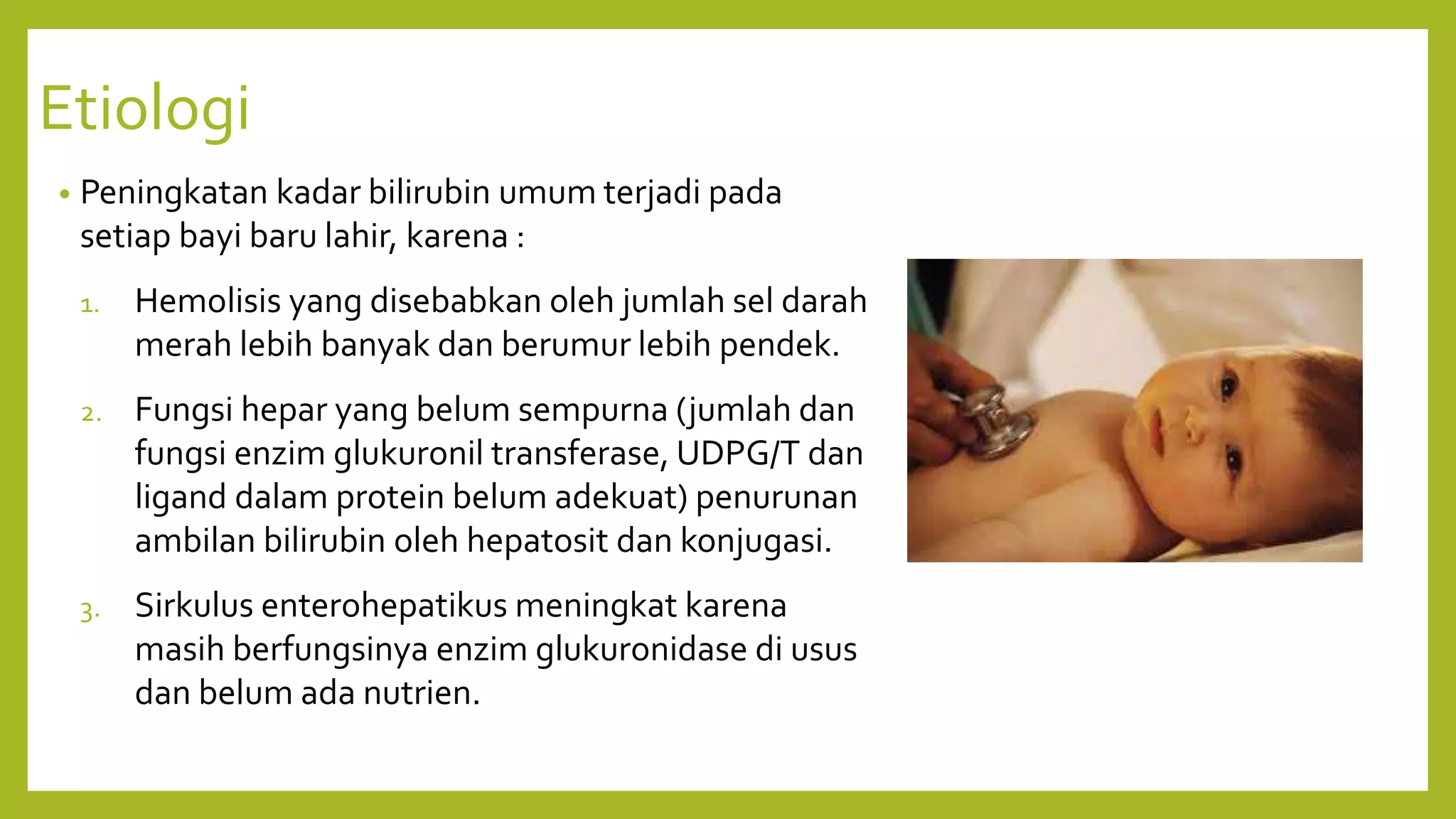Ikterus Neonatus | PPTX