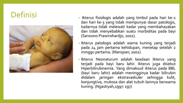 Ikterus Neonatus | PPTX