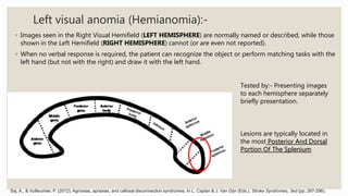 Disconnection_syndrome.pptx | Brain and Nervous System Disorders ...