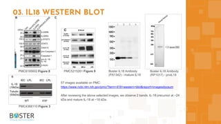 Learn IL18 in 3 minutes | Interleukin-18 | PPTX