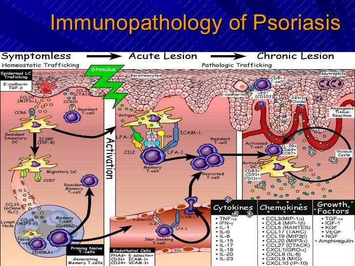 Il17 &stat 3 in psoriasis pathogenesis