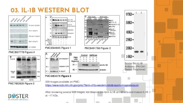 Learn IL-1 Beta in 3 minutes | Interleukin-1 beta, IL1B, IL-1F2 | PPTX