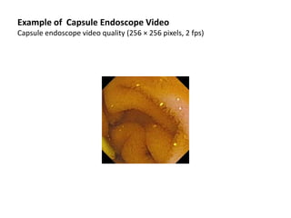 Medical sensing, localization, and communications usingultra wideband ...