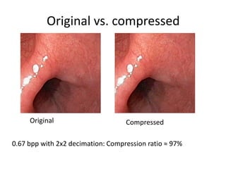 Medical sensing, localization, and communications usingultra wideband ...