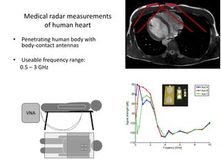 Medical sensing, localization, and communications usingultra wideband ...