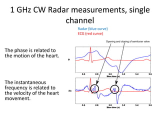 Medical sensing, localization, and communications usingultra wideband ...