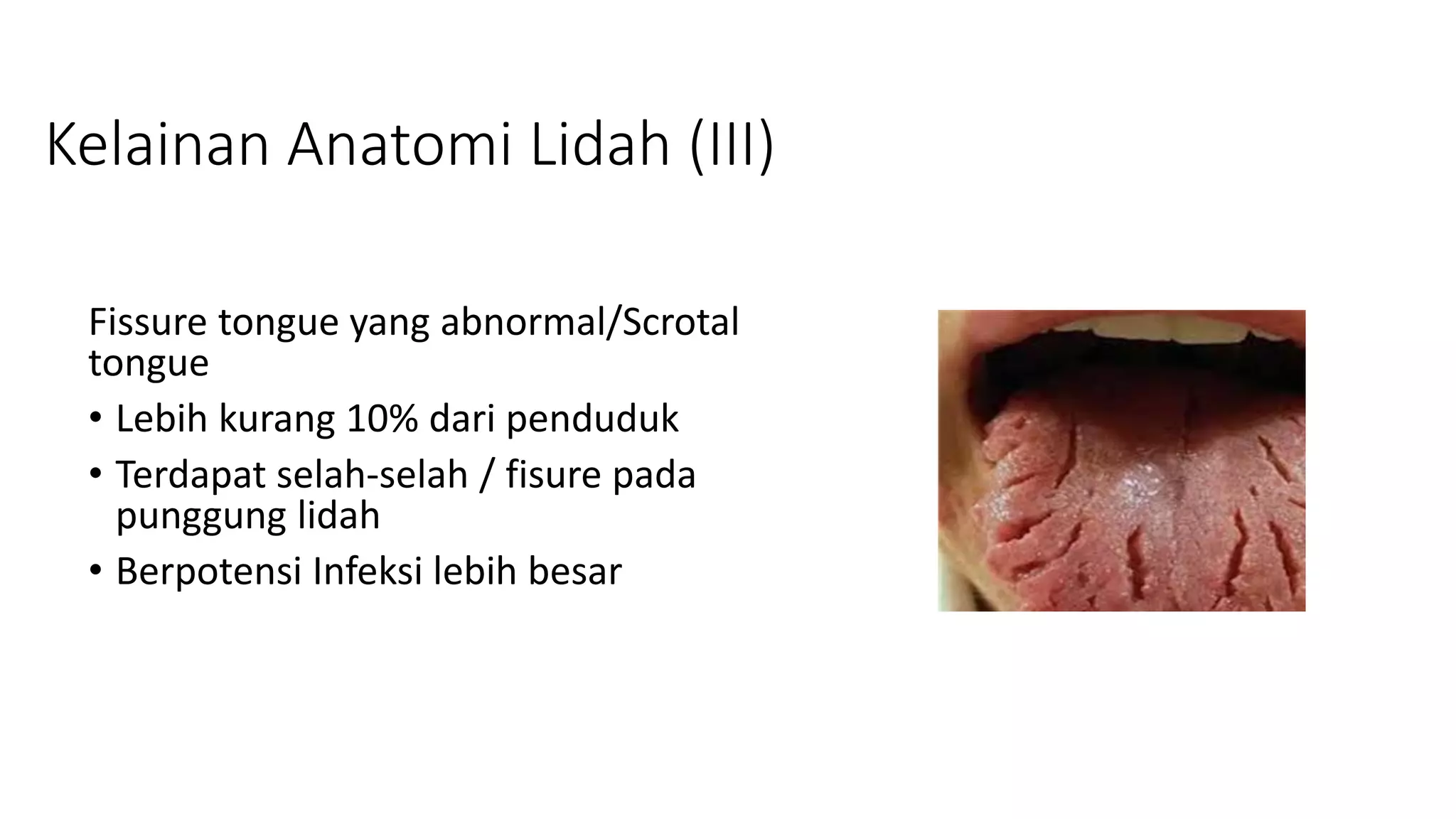 Anatomi & Fisiologi Lidah | PPTX