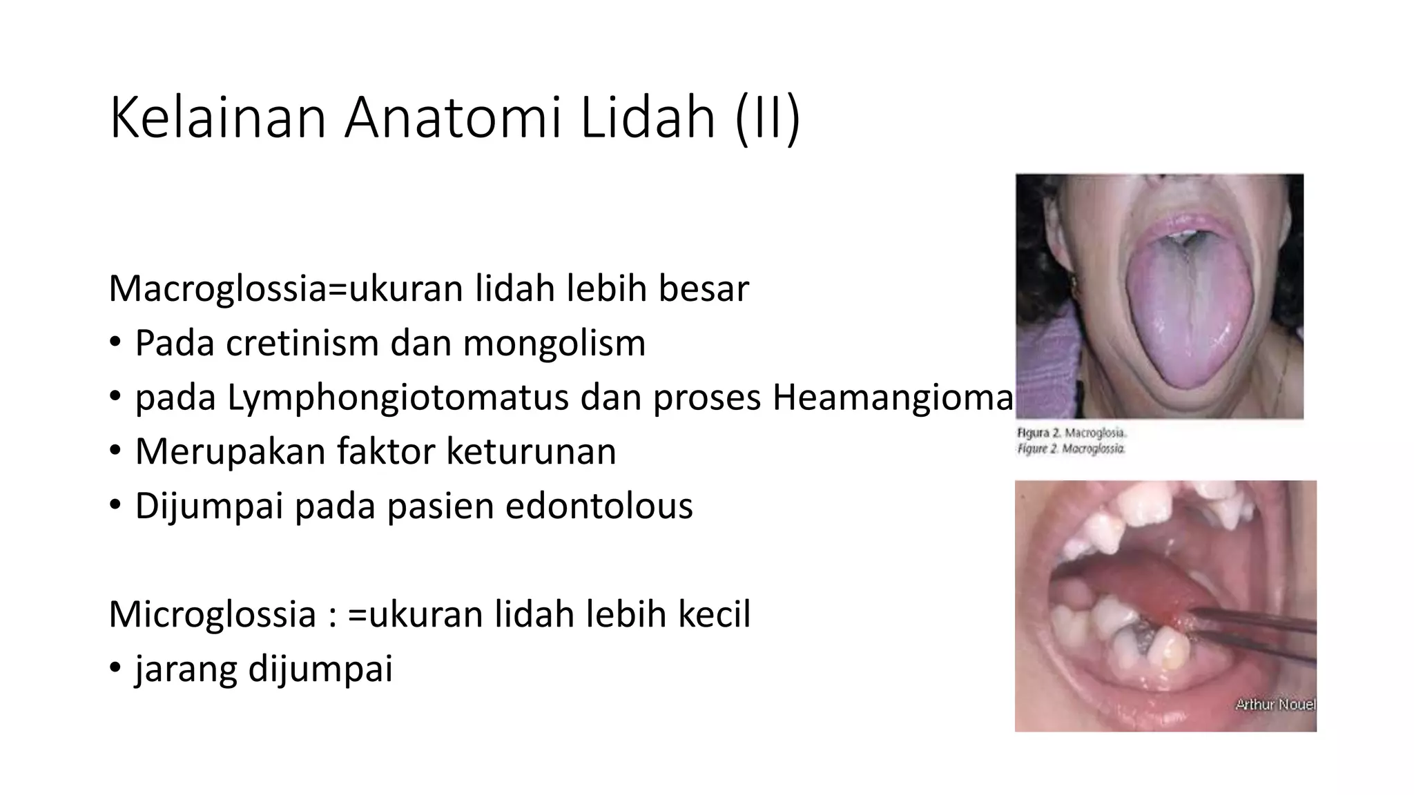 Anatomi & Fisiologi Lidah | PPTX