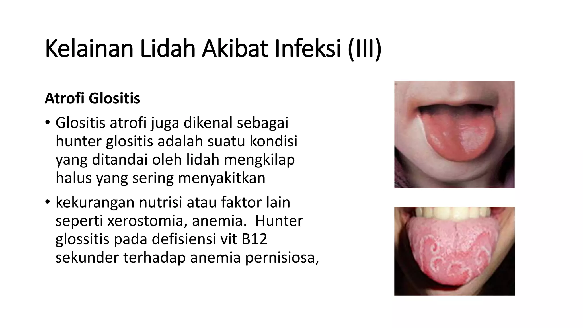 Anatomi & Fisiologi Lidah | PPTX