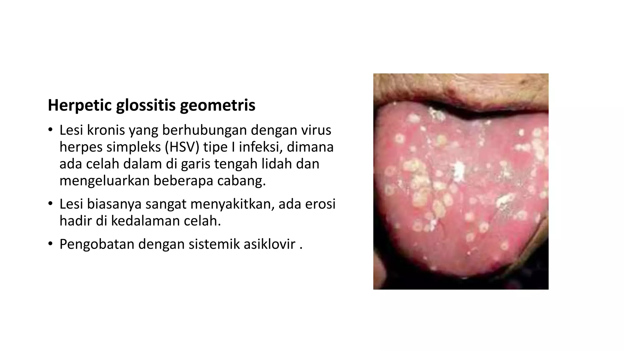 Anatomi & Fisiologi Lidah | PPTX