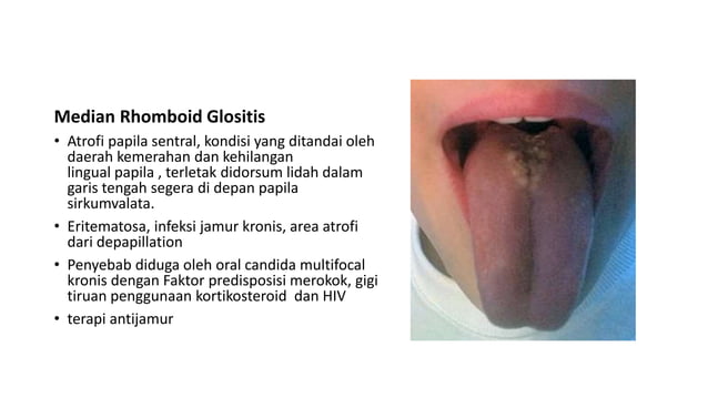 Anatomi & Fisiologi Lidah | PPTX
