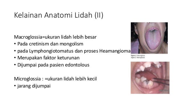 Anatomi & Fisiologi Lidah
