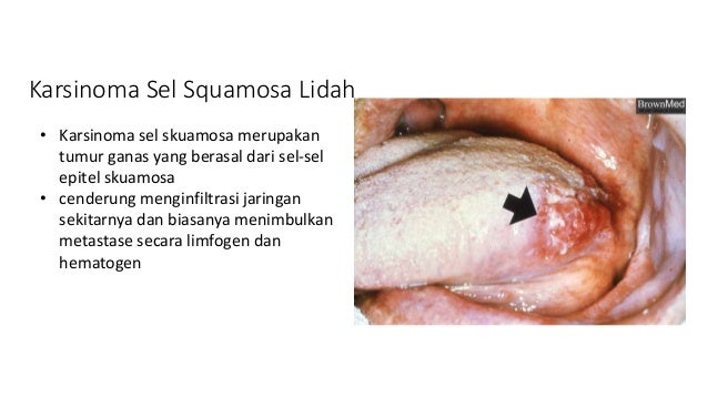 Anatomi & Fisiologi Lidah