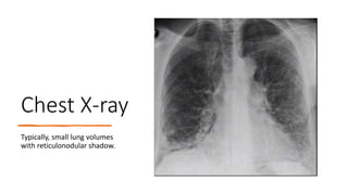 Interstitial Lung Disease | PPTX